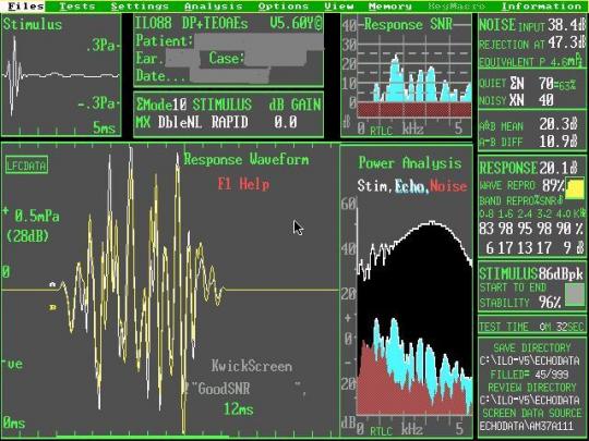 La audición en adultos » Sordera y Vértigo